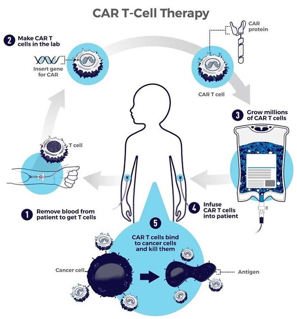 chimeric antigen receptor T-cell (CAR-T) therapy - Sanskriti IAS