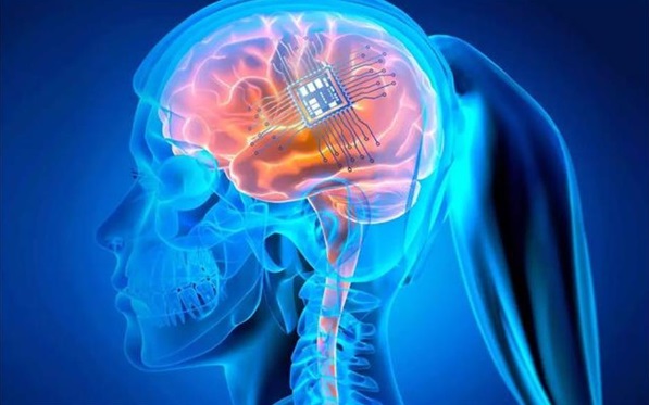 Chip implanted in human brain - Sanskriti IAS